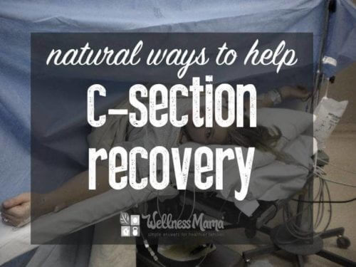 C-Section Recovery: Natural Ways to Heal Faster | Wellness Mama