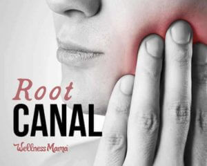 Are There Hidden Dangers to Getting a Root Canal? | Wellness Mama