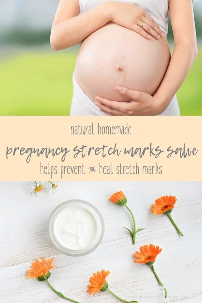Natural Pregnancy Stretch Mark Salve | Wellness Mama