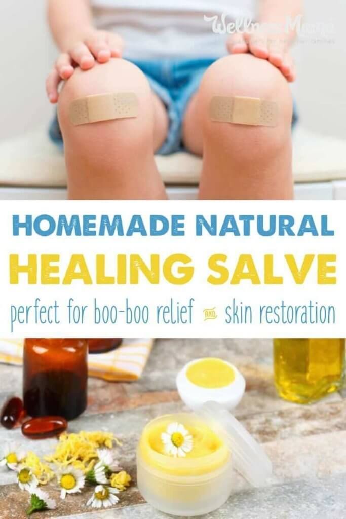 Homemade Healing Salve